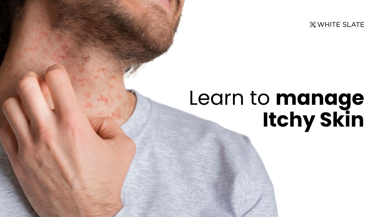 Learn to manage itchy skin – WHITE SLATE